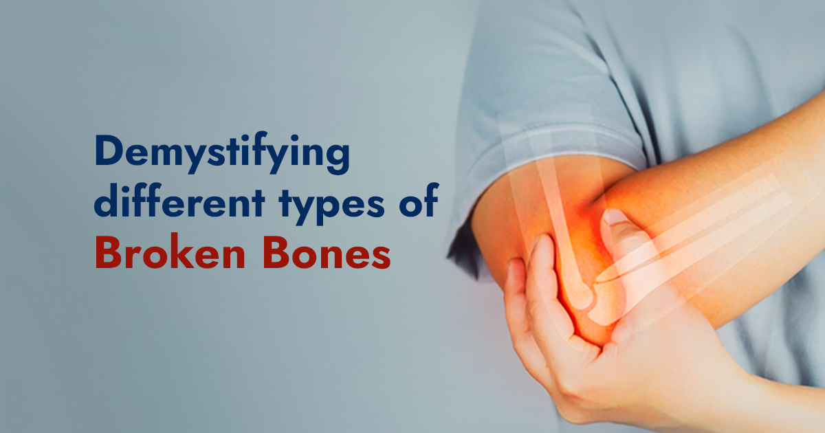Demystifying Different Types Of Broken Bones Dr Tdr Reddy
